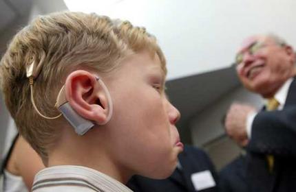 When was Bionic Ear invented? – When was it invented?