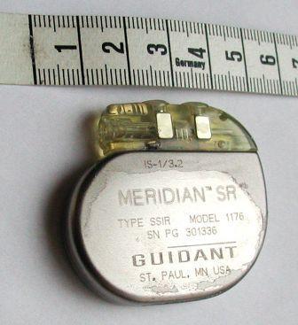 When was the first Internal Pacemaker invented? – When was it invented?